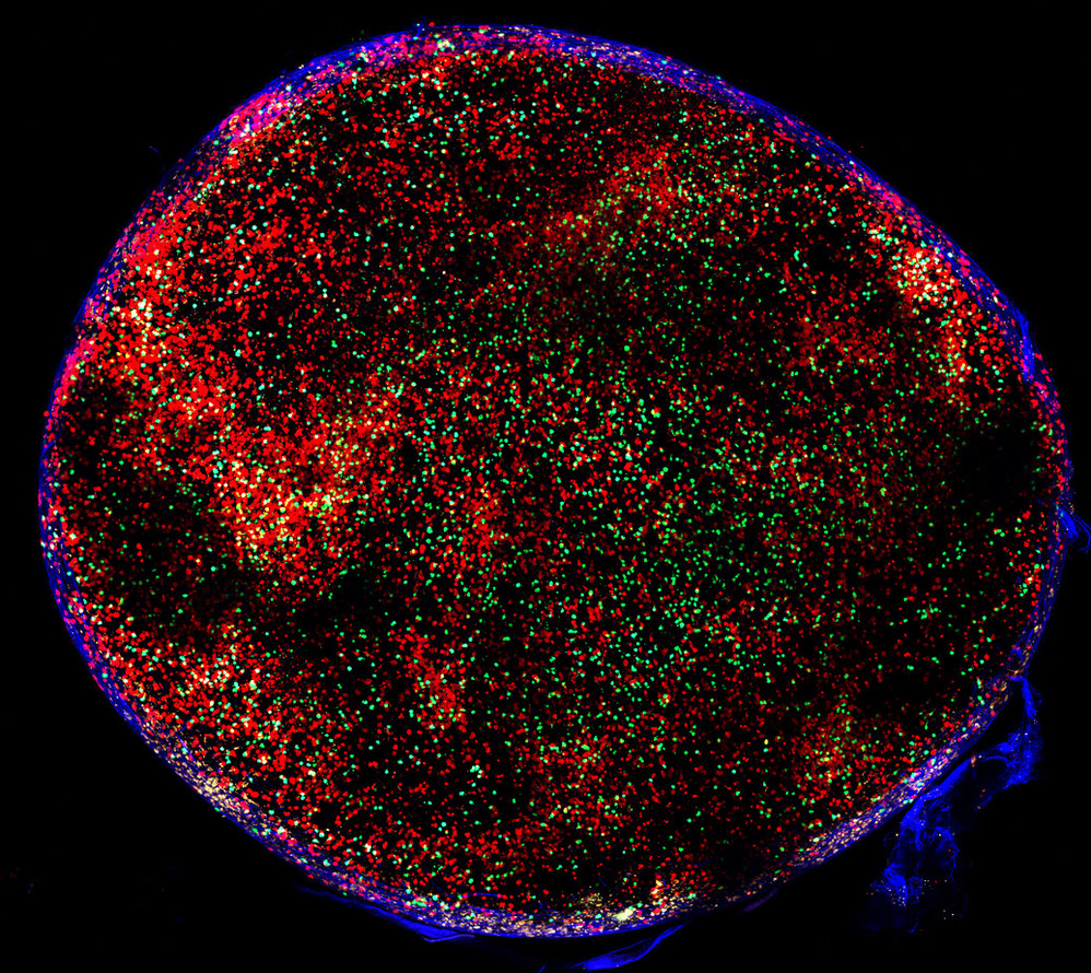 The Rockefeller University » How the body's B cell academy ensures a ...