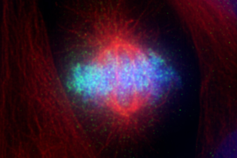 The Rockefeller University » Research on cell division provides new ...