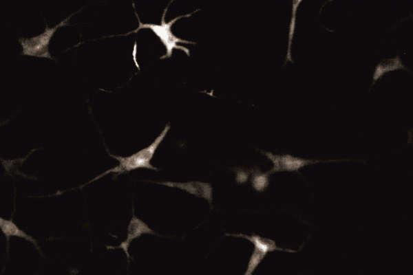 Skin Cells Emit Neuron-Like Bursts Much like Brain Cells, Research Finds