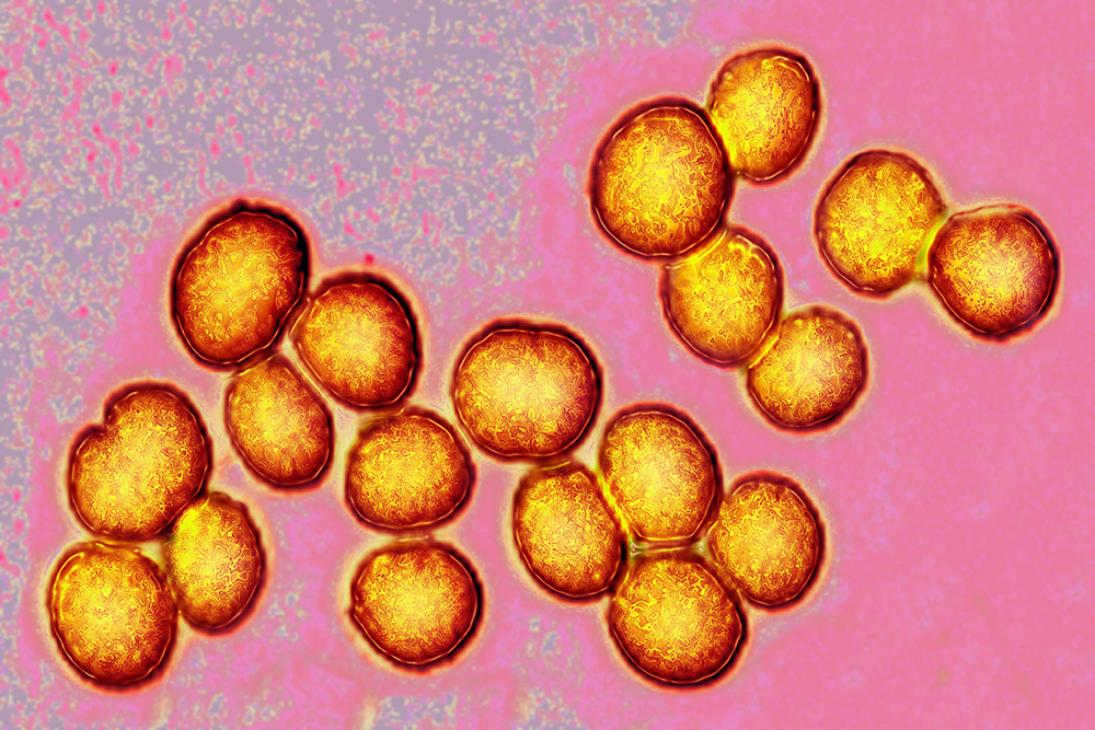 The Rockefeller University » How bacteria recognize viral invasion and ...