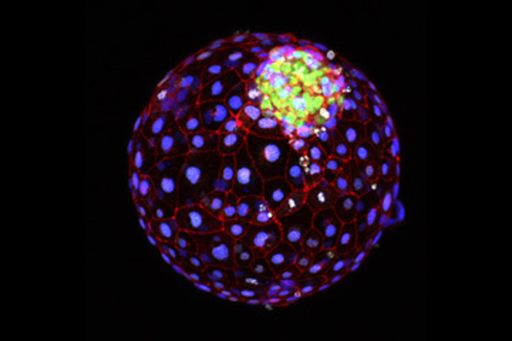 The Rockefeller University » Stem cell model offers first glimpse of ...