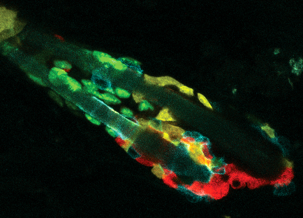 The Rockefeller University » Surprising mechanism for removing dead ...