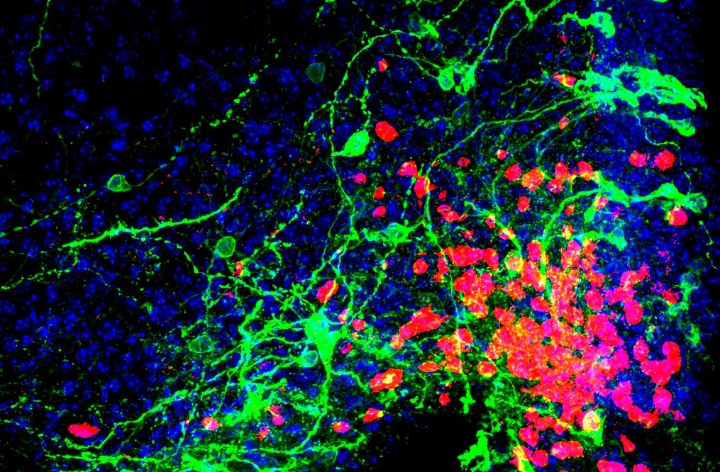 The Rockefeller University » Newly discovered neurons change our ...